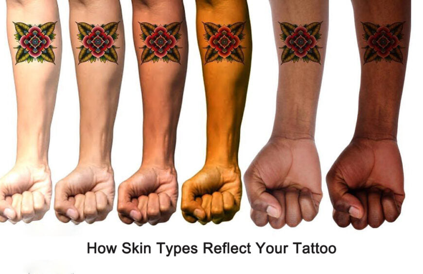 Dermatological Dynamics: The Influential Role of Skin Types in Tattoo